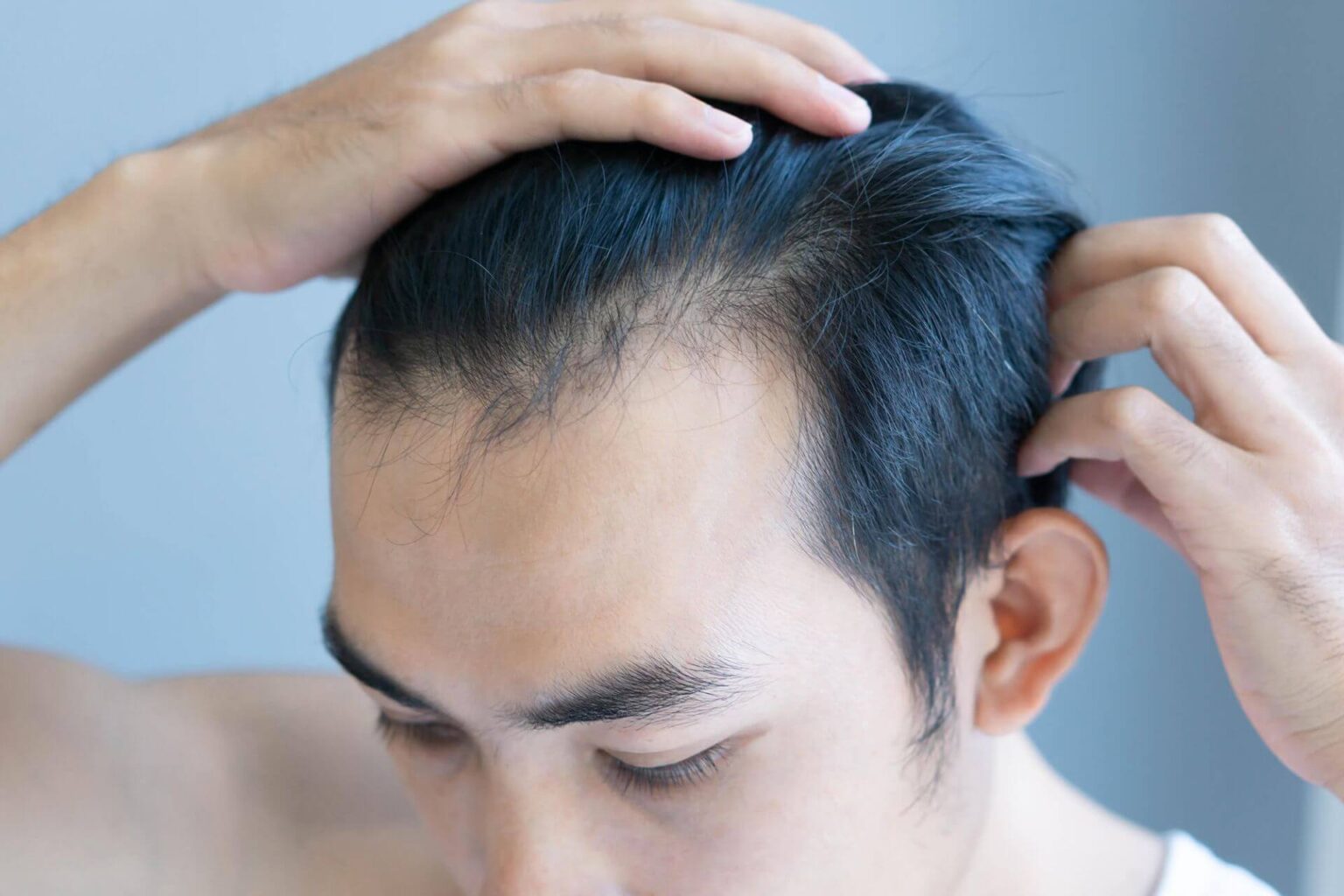 What Causes an Uneven Hairline and How Can You Fix It? - Lockerz